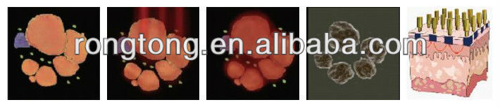 a_