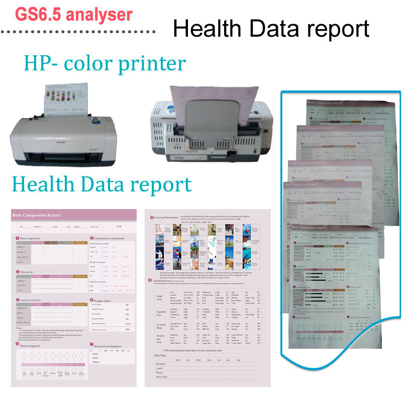 GS6.5-printer.jpg