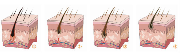 Professional-Portable-7iIn-1-Elight-Lamp-Handpiece-Laser-OPT-SHR-Hair-Removal-IPL-Machine-RF-skin-tightening.png