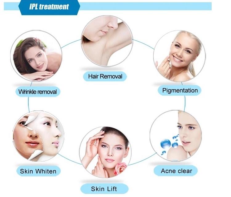 ipl treatment.jpg