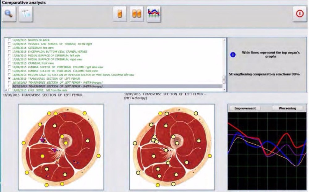Cacciatore 4025 di Metatron con software tedesco
