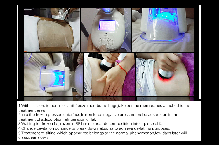 Potente!!!macchina di congelamento grassa della liposuzione di cavitazione cryolipolysis a macchina/ultrasonico di cryolipolysis da vendere
