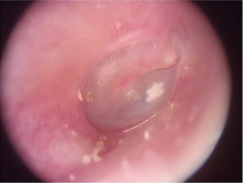 Ophthalmoscope tenu dans la main Dermatoscope d'otoscope d'inspection de Digital avec l'écran de l'affichage à cristaux liquides 3.5inch