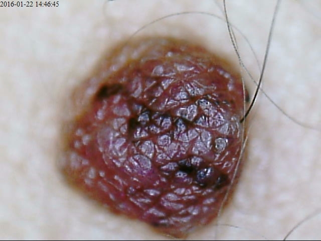 Cabelo Analyer Dermatoscope video observando a pele e cabelo com 200 vezes Picures armazenado ampliação no cartão do SD