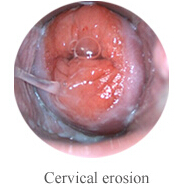 Mini Colposcope voor Cervicale Examintion Zelf - Examen Digitale Elektronische die Colposcope BS1 met TV wordt verbonden