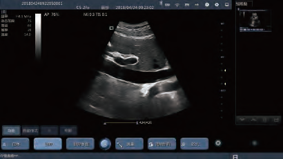 Handy-Sonden-drahtlose Ultraschall-Sonden-konvexe lineare Transvaginal Mikro-konvexe veränderbare Sonde