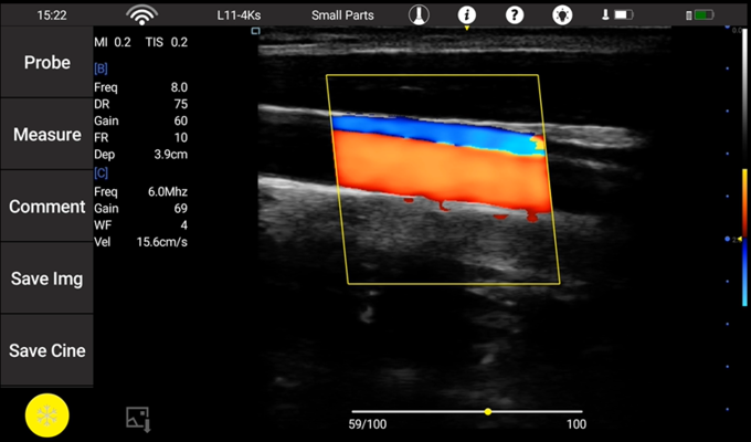 Punta de prueba cardiaca linear convexa del ultrasonido de la punta de prueba de la punta de prueba inalámbrica transvaginal del ultrasonido desmontable