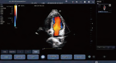 Dispositivi diagnostici ultrasonici portatili di ultrasuono della sonda di ultrasuono di colore senza fili transvaginale della sonda