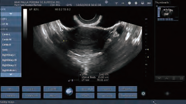 Dispositivi diagnostici ultrasonici portatili di ultrasuono della sonda di ultrasuono di colore senza fili transvaginale della sonda