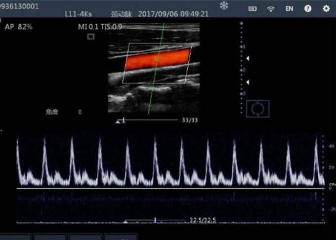 Farb-Doppler-Ultraschall-Sonden-Handultraschall-Gerät für Mobiltelefon/PC