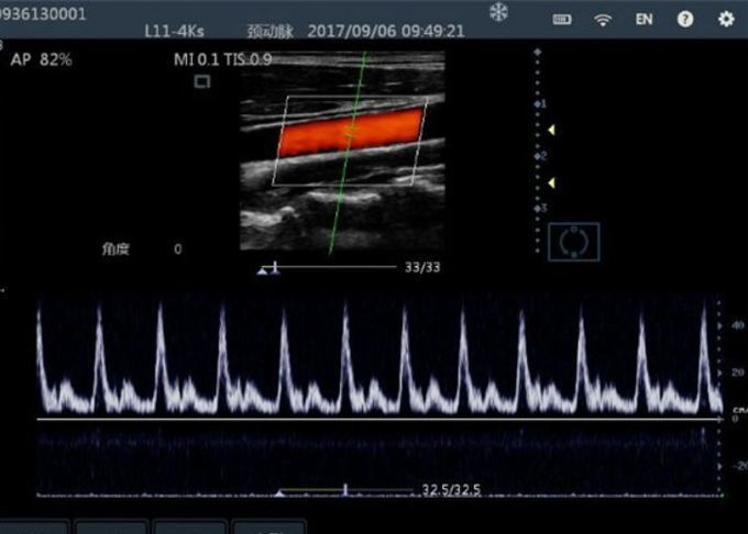Van de de Ultrasone klanksonde van kleurendoppler Handbediend de Ultrasone klankapparaat voor Mobilofoon/PC