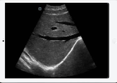 Sonda cardiaca lineare convessa di ultrasuono della sonda della sonda senza fili transvaginale di ultrasuono staccabile