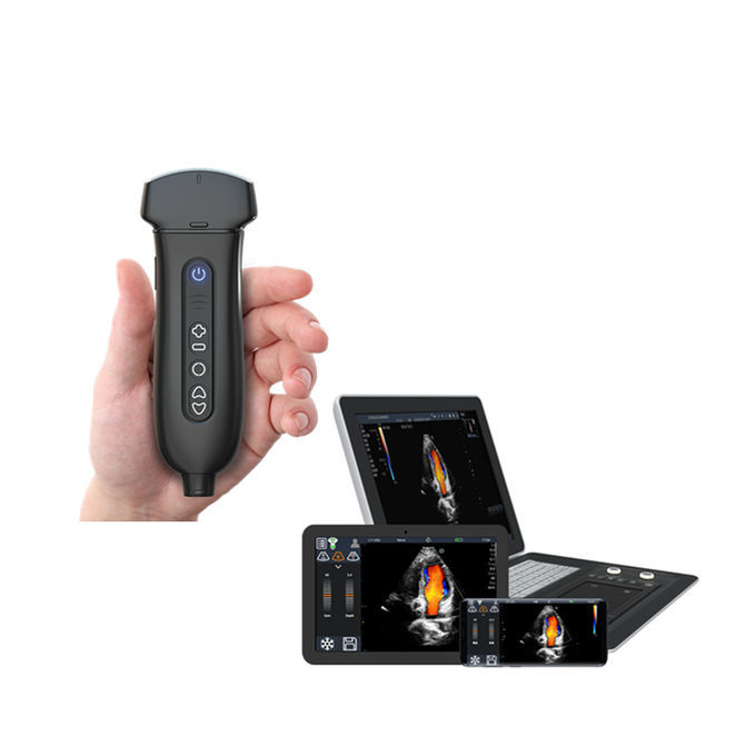 Varredor médico do ultrassom de Doppler da cor da máquina da varredura do ultrassom com transdutor cardíaco