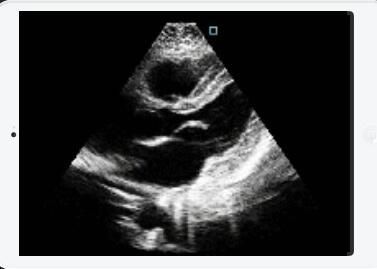 Varredor médico do ultrassom de Doppler da cor da máquina da varredura do ultrassom com transdutor cardíaco