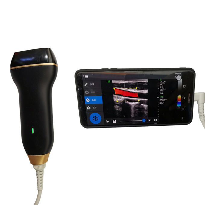 Haupt- Ultraschall-Darstellungs-Maschinen-Farb-Doppler-Ultraschall-Scanner mit USB-Verbindung