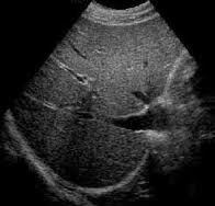 Tragbarer Ultraschall-Scanner Handultraschall Devics mit 10,4-Zoll hohem Entschließungs-Schirm