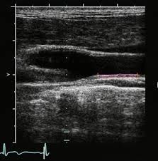 Tragbarer Ultraschall-Scanner Handultraschall Devics mit 10,4-Zoll hohem Entschließungs-Schirm