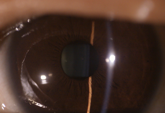 40° разрешения 2560 x 1920 пикселов цифров Fundus камера Fundus ручного фокуса камеры портативная