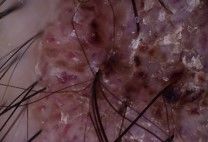 Digital Dermoscope che video Dermatoscope ha polarizzato gli archivi a 3,5 pollici disponibili leggeri di TFT LCD di colore pieno ha trasferito al PC 0
