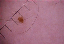 Digital Dermoscope che video Dermatoscope ha polarizzato gli archivi a 3,5 pollici disponibili leggeri di TFT LCD di colore pieno ha trasferito al PC 3