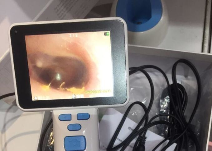 Otoscope video Handheld de Digitas com diâmetro da mini USB conexão do lense 0.5cm 8 horas de Continouns que trabalha 1