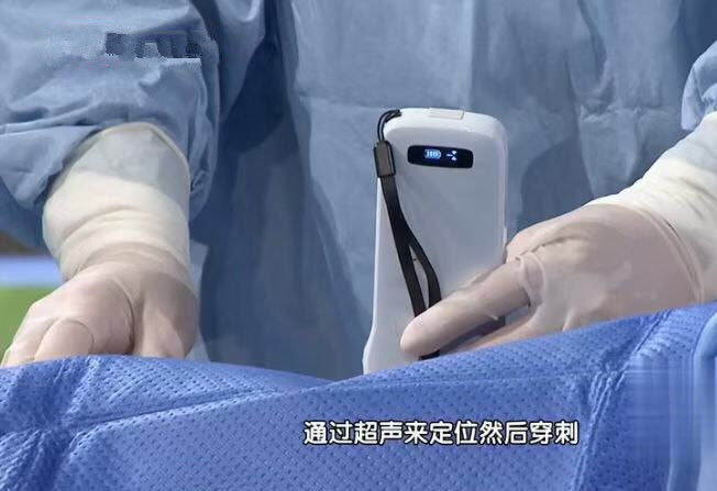van de de Ultrasone klankscanner van 5G Wifi steunde de Handbediende van de de Zakultrasone klank Ingebouwde 4200mAh van de het Lithiumbatterij Draadloze Lader 0