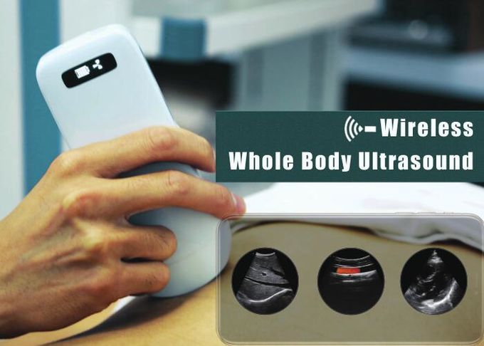 van de de Ultrasone klankscanner van 5G Wifi steunde de Handbediende van de de Zakultrasone klank Ingebouwde 4200mAh van de het Lithiumbatterij Draadloze Lader 1