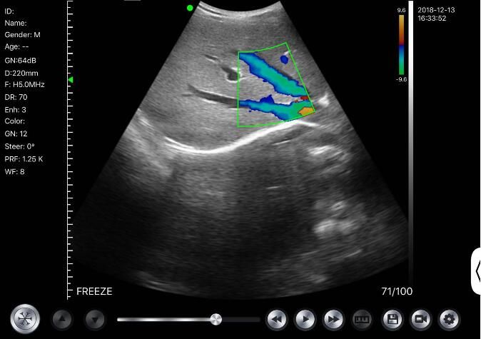 Color Doppler de Mini Handheld Ultrasound Scanner Portable con los elementos de múltiples frecuencias 2-10MHz 128 64 canales 5