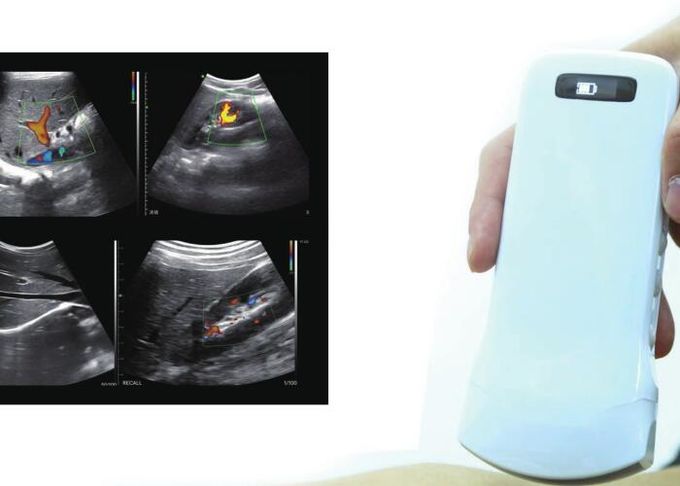 Color Doppler de Mini Handheld Ultrasound Scanner Portable con los elementos de múltiples frecuencias 2-10MHz 128 64 canales 4
