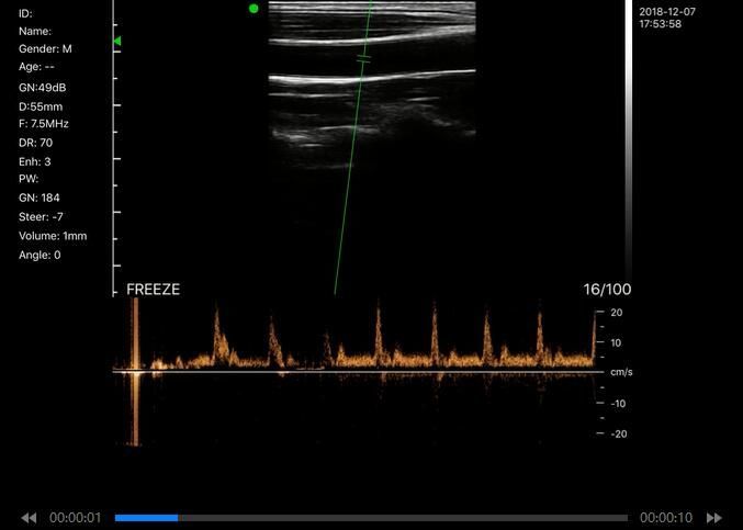 L'analizzatore tenuto in mano di ultrasuono di doppler di colore di Wifi lineare e convesso collegato all'IOS Windows di Android del cellulare hanno sostenuto 5