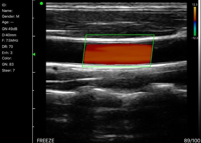 La sonda tenuta in mano Mini Ultrasound Only 235g di ultrasuono della sonda senza fili di ultrasuono della tasca pesa 128 elementi 2.4G Wifi 3
