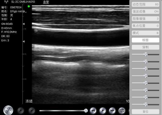 La sonda tenuta in mano Mini Ultrasound Only 235g di ultrasuono della sonda senza fili di ultrasuono della tasca pesa 128 elementi 2.4G Wifi 5